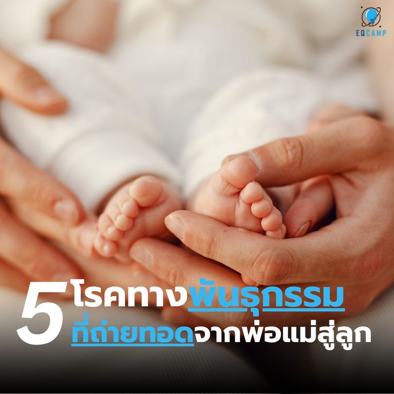 [eq Camp] 5 โรคทาง พันธุกรรม ที่ถ่ายทอดจากแม่สู่ลูก โรคทางพันธุกรรม