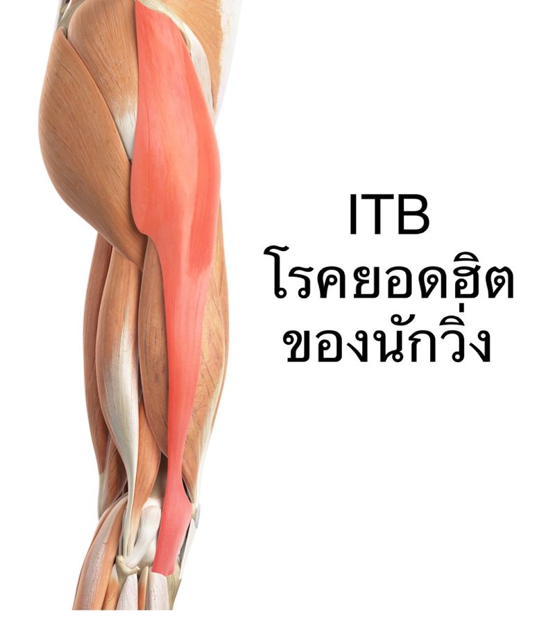 [หมอเฝิง แพทย์แผนจีน] ITB โรคยอดฮิตของนักวิ่ง โรค ITB หรือ Iliotibial ...