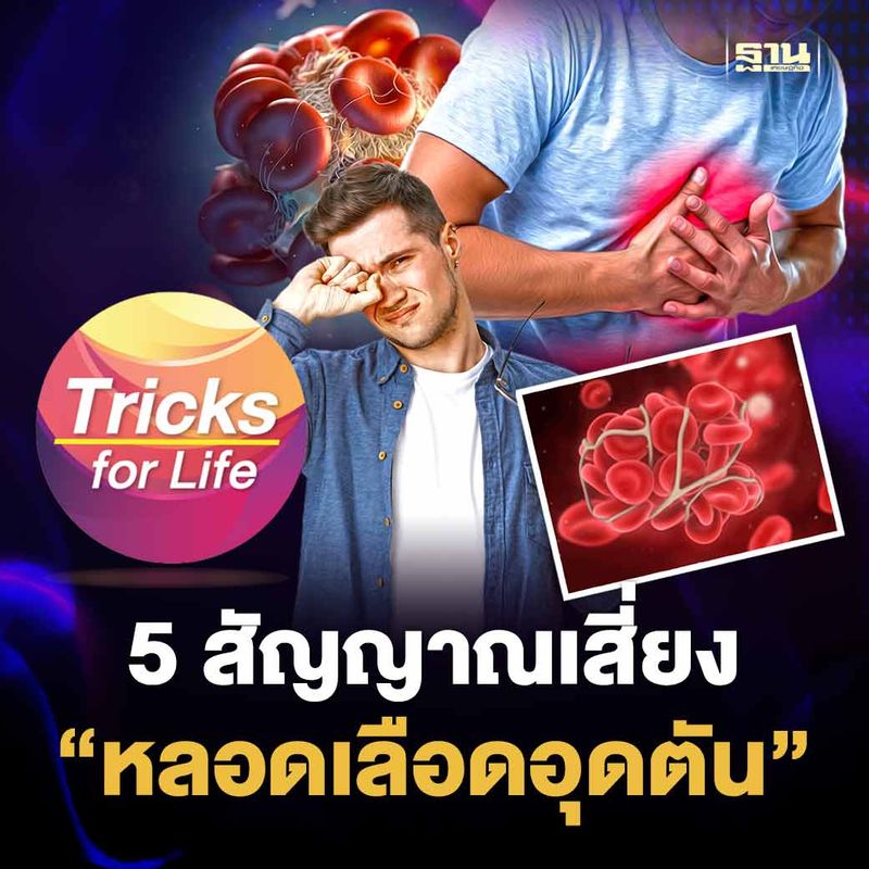 [ฐานเศรษฐกิจ_Thansettakij] 5 สัญญาณเสี่ยง “หลอดเลือดอุดตัน” 5 สัญญาณเสี่ยง “หลอดเลือดอุดตัน ...