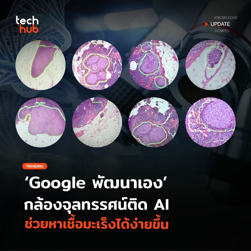 [Techhub] Google พัฒนากล้องจุลทรรศน์ ติด AI ช่วยวินิจฉัยโรคมะเร็ง [แพทย์อนาคต] การมาของ AI ไม่ ...