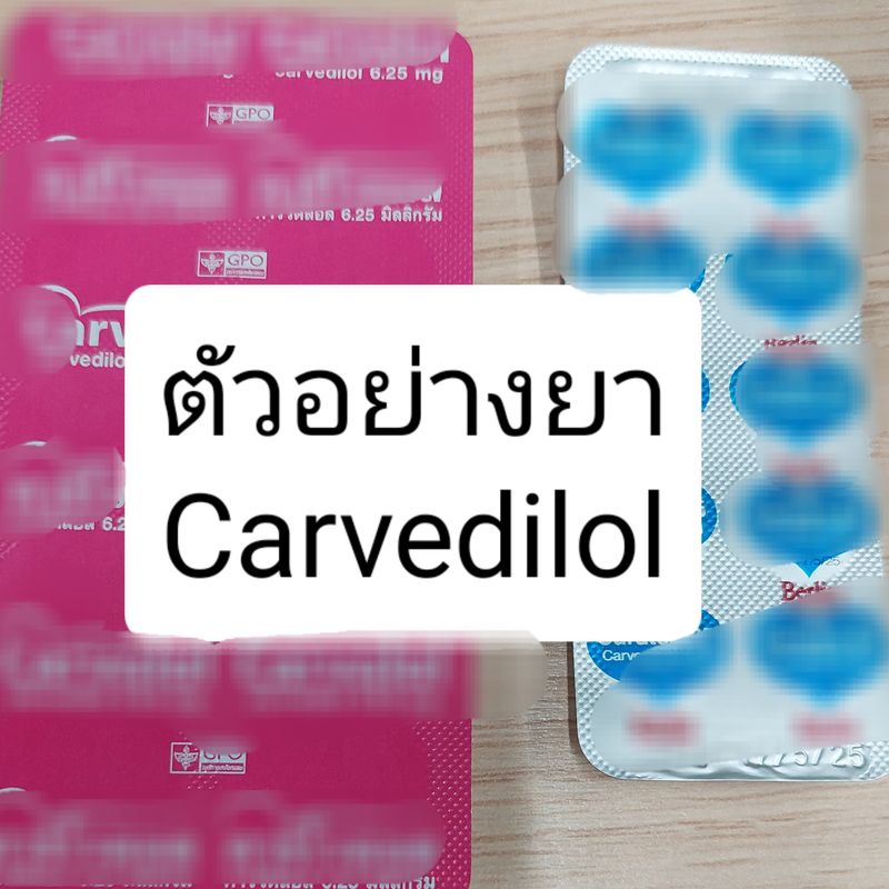 [เรื่องเล่าจากห้องยา] Carvedilol- คาร์วีดิลอล เป็นยาลดความดันในกลุ่ม ...
