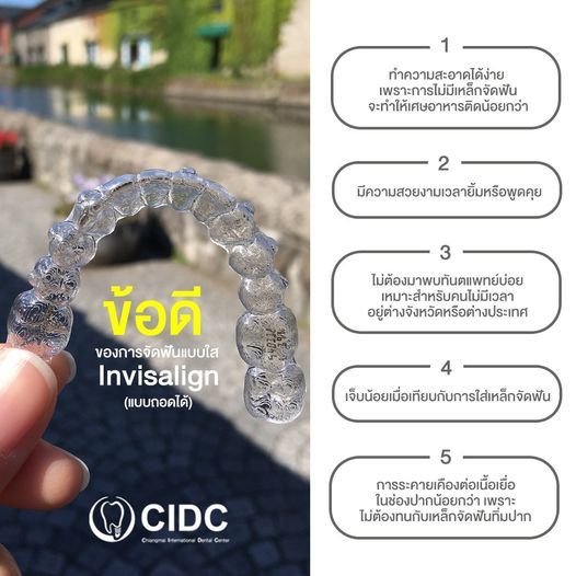 [CIDC Chiang Mai Dental Clinic] ข้อดี! ของการจัดฟันใส invisalign จัดฟันใส (𝐢𝐧𝐯𝐢𝐬𝐚𝐥𝐢𝐠𝐧)💎 เป็นที่ ...