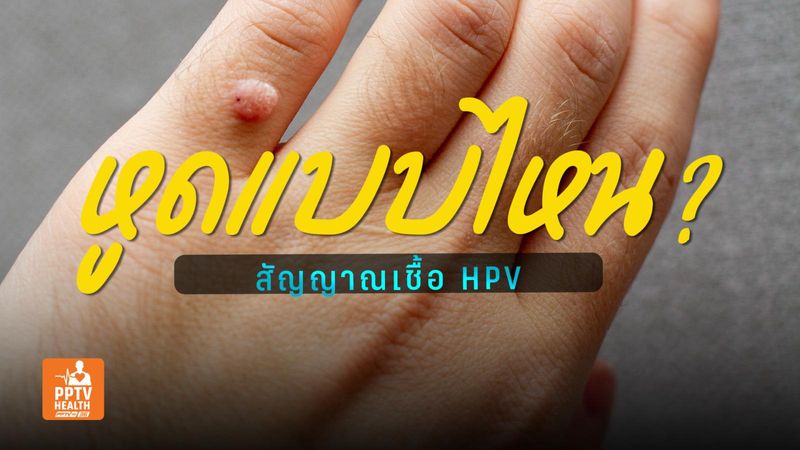 [PPTVHD36] "หูด"สัญญาณติดเชื้อ HPV- หูดหงอนไก่เสี่ยงมะเร็งปากมดลูกหรือไม่? รู้หรือไม่? เชื้อ HPV ...