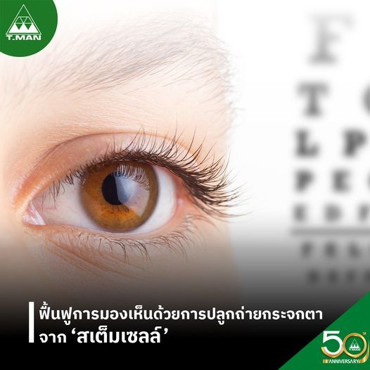 [T.MAN PHARMACEUTICAL] T.MAN พามารู้จัก นวัตกรรมฟื้นฟูกระจกตา ด้วยการ ...