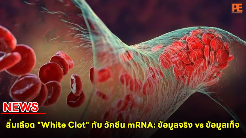 [Professional Expert] ลิ่มเลือด "White Clot" กับ วัคซีน mRNA: ข้อมูล ...