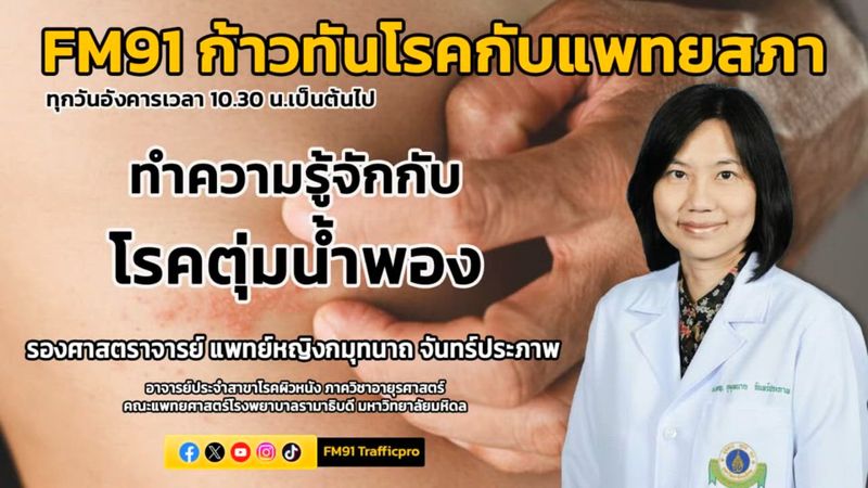 [FM91 Trafficpro] ทำความรู้จักกับโรคตุ่มน้ำพอง : FM91 ก้าวทันโรคกับแพทยสภา สัมภาษณ์ รอง ...
