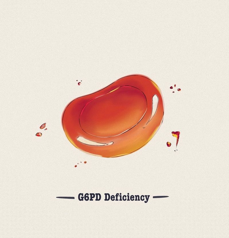 [PHARM DRiP] #EP05 Drug to avoid in G6PD deficiency - ในการทำงานที่ผ่าน ...