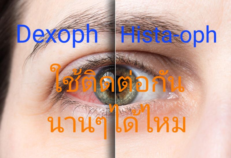 [เรื่องเล่าจากห้องยา] ผู้ป่วยได้รับยาหยอดตา 2 ชนิด เป็นยา Dexa oph กับ Hista oph แล้วใช้ต่างกัน ...