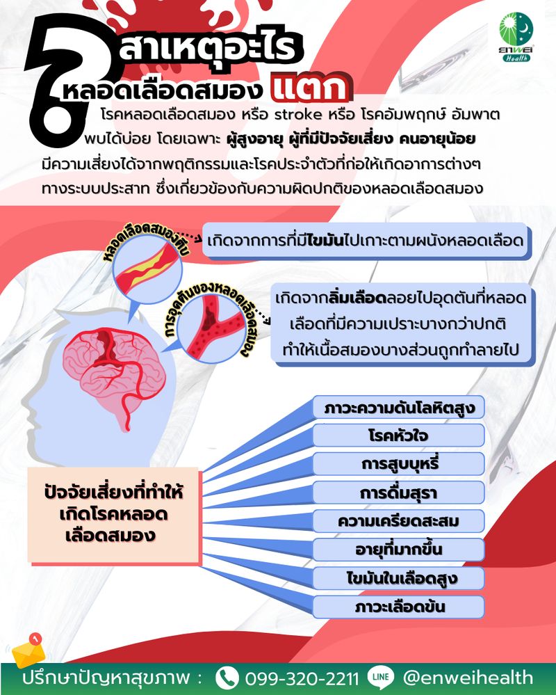 [ENWEI HEALTH] สาเหตุที่ทำให้หลอดเลือดสมองปริแตก ดูแลสุขภาพร่างกายให้ ...