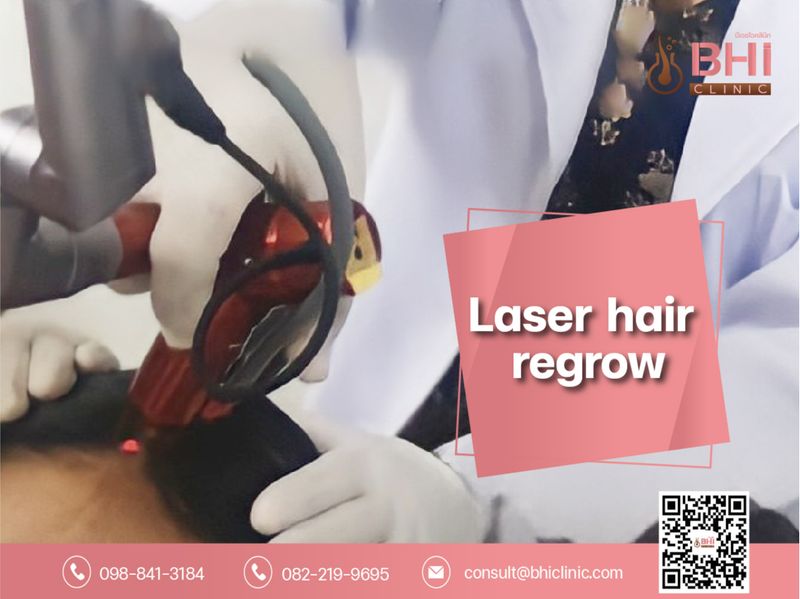 [DR.BHI] รักษาผมร่วง ด้วยเทคโนโลยี LASERs ชึ้นชื่อว่า LASER คนส่วนใหญ่ ...