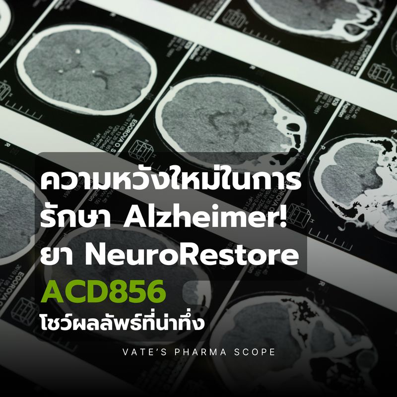 [Vate's Pharma Scope] ความหวังใหม่ในการรักษา Alzheimer! ยา NeuroRestore ...