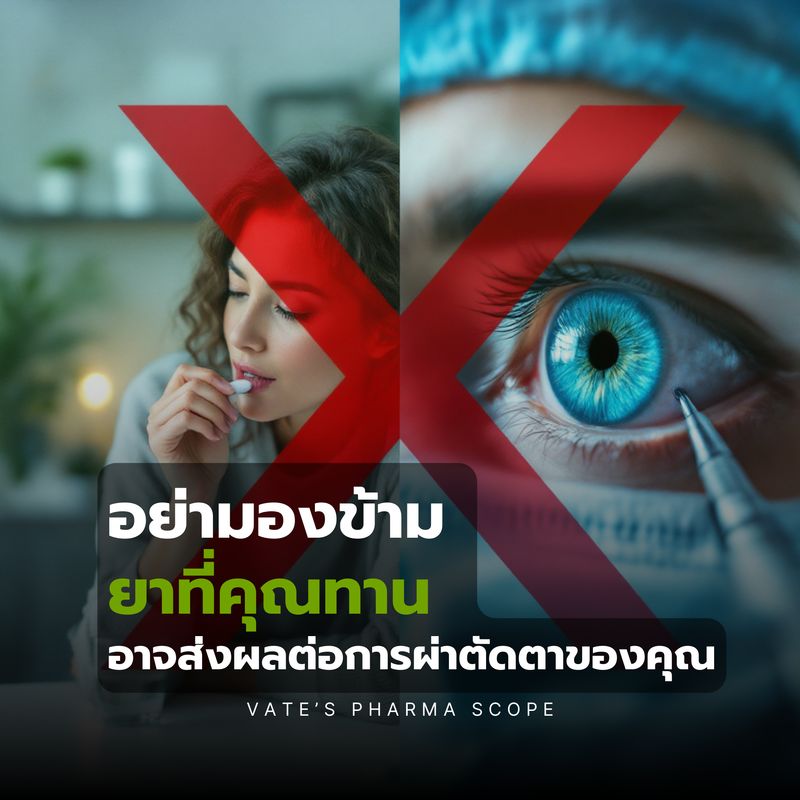 [Vate's Pharma Scope] อย่ามองข้าม ยาที่คุณทาน อาจส่งผลต่อการผ่าตัดตาของคุณ บทความนี้ขอนำเสนอ ...