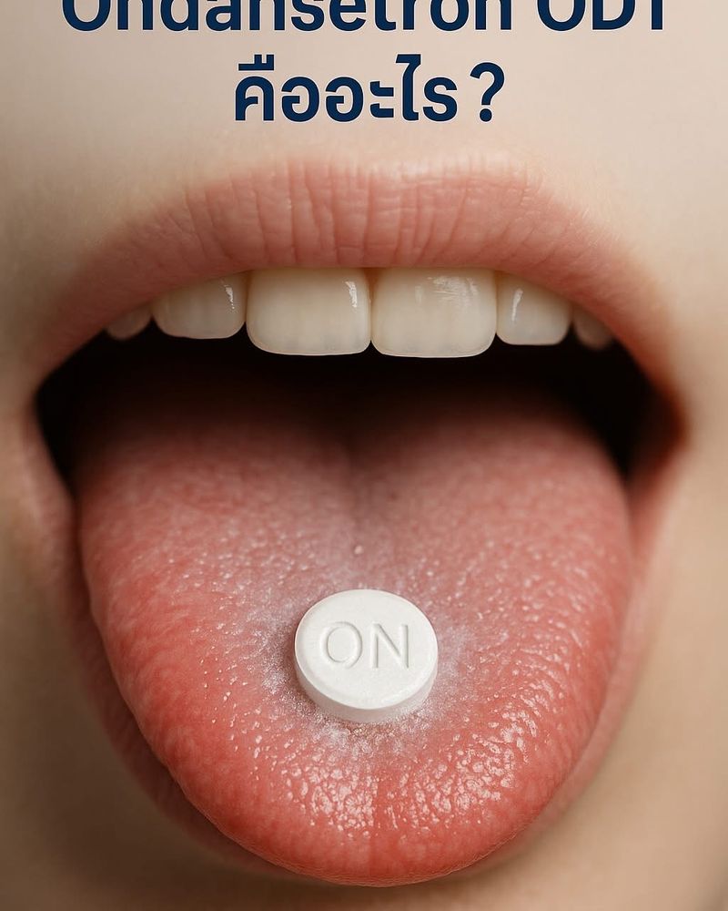 [สุขภาพดีไม่มีในขวด] Ondansetron ODT คืออะไร ? Ondansetron เป็นยาต้าน ...